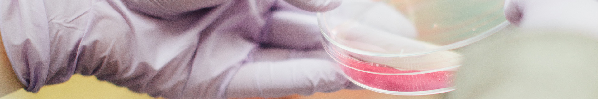 Polyurethane black and white material, polymeric MDI, modified MDI ...