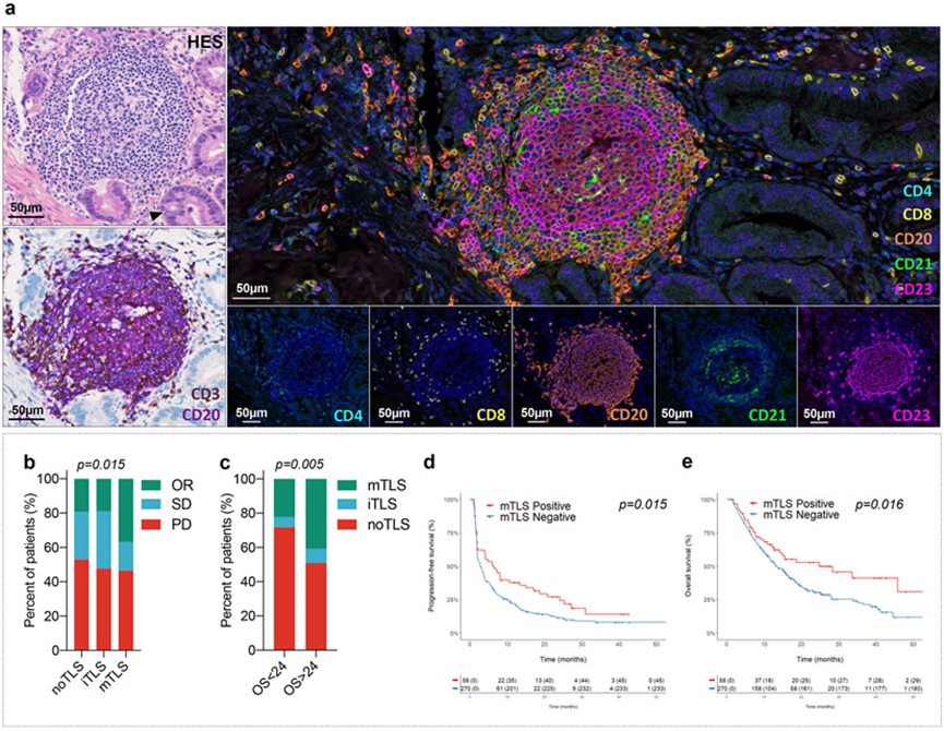 多重免疫荧光（mIHC）解析三级淋巴结构（TLS）对抗肿瘤免疫的重要作用