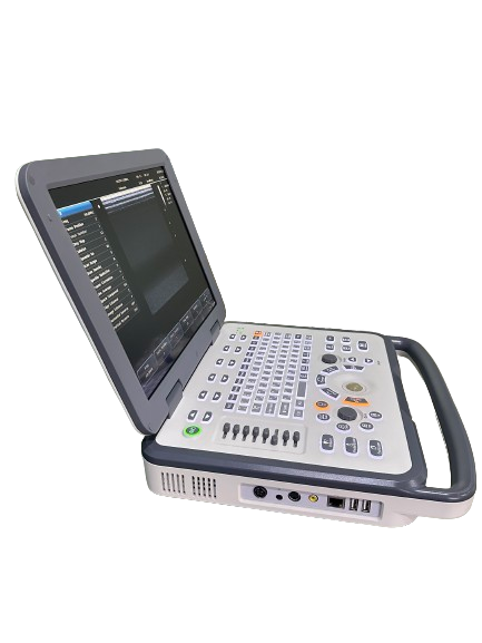 Color Doppler Notebook Diagnostic Ultrasound System