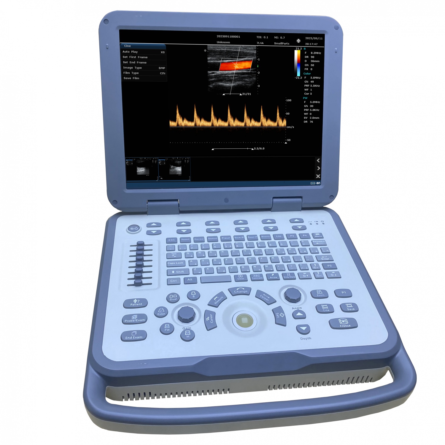 Color Doppler Notebook Diagnostic Ultrasound System