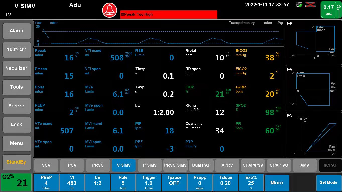 ICU Ventilator Crius V6,Medconcept Technology Limited